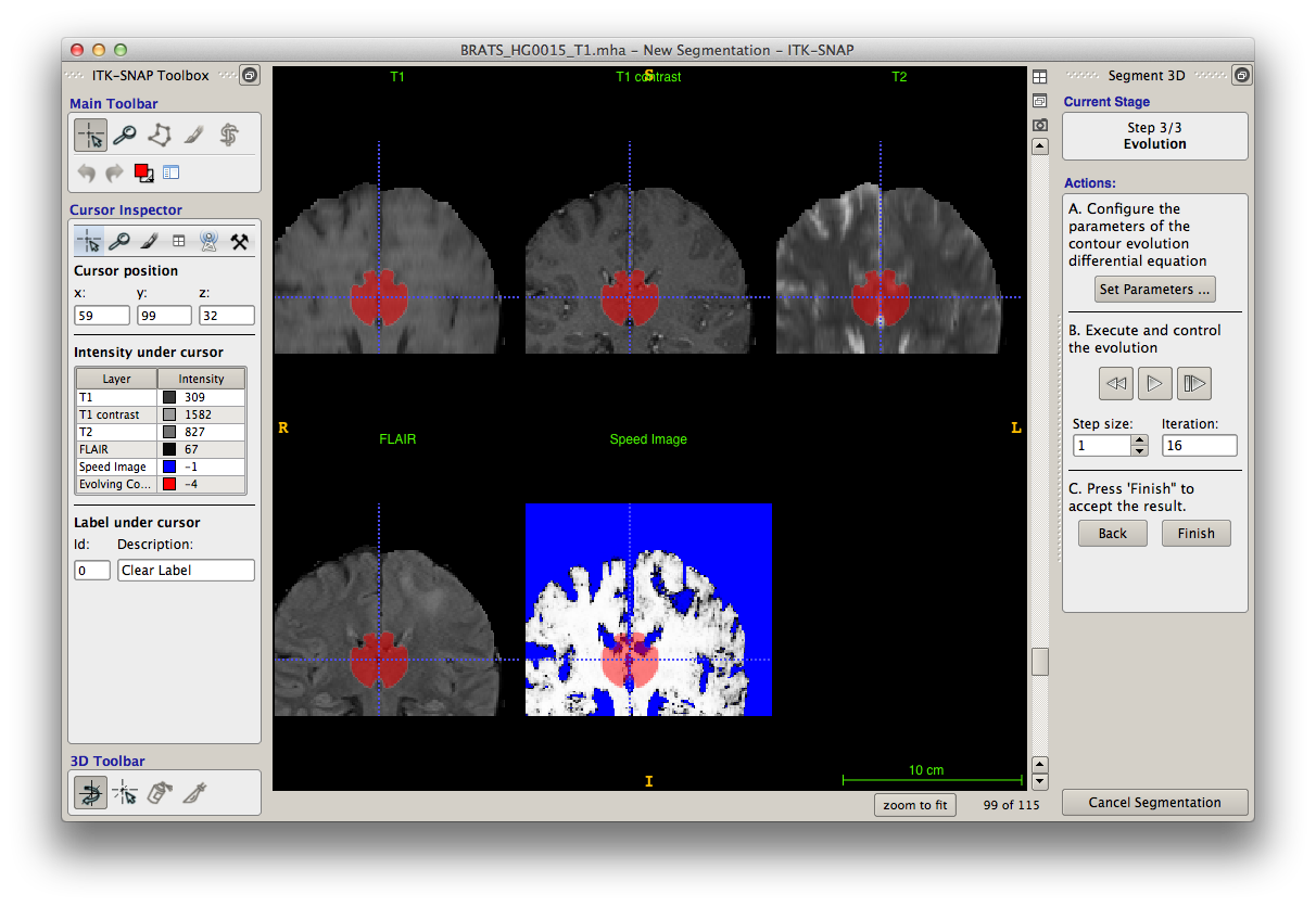 ITK-SNAP Medical Image Segmentation Tool - Download